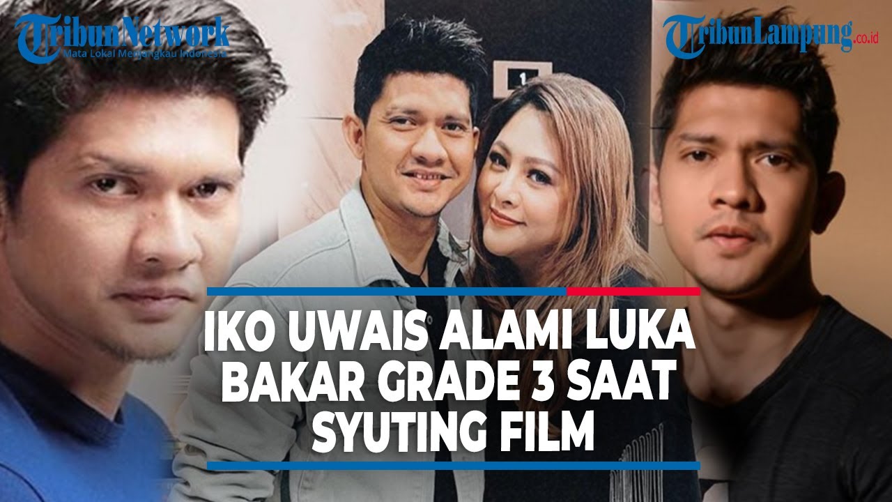IKO UWAIS ALAMI LUKA BAKAR GRADE 3 SAAT SYUTING FILM @TRIBUNLAMPUNGNEWSVIDEO - YouTube
