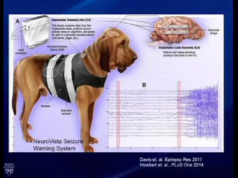 Seizure prediction algorithm development and validation via kaggle.com - YouTube