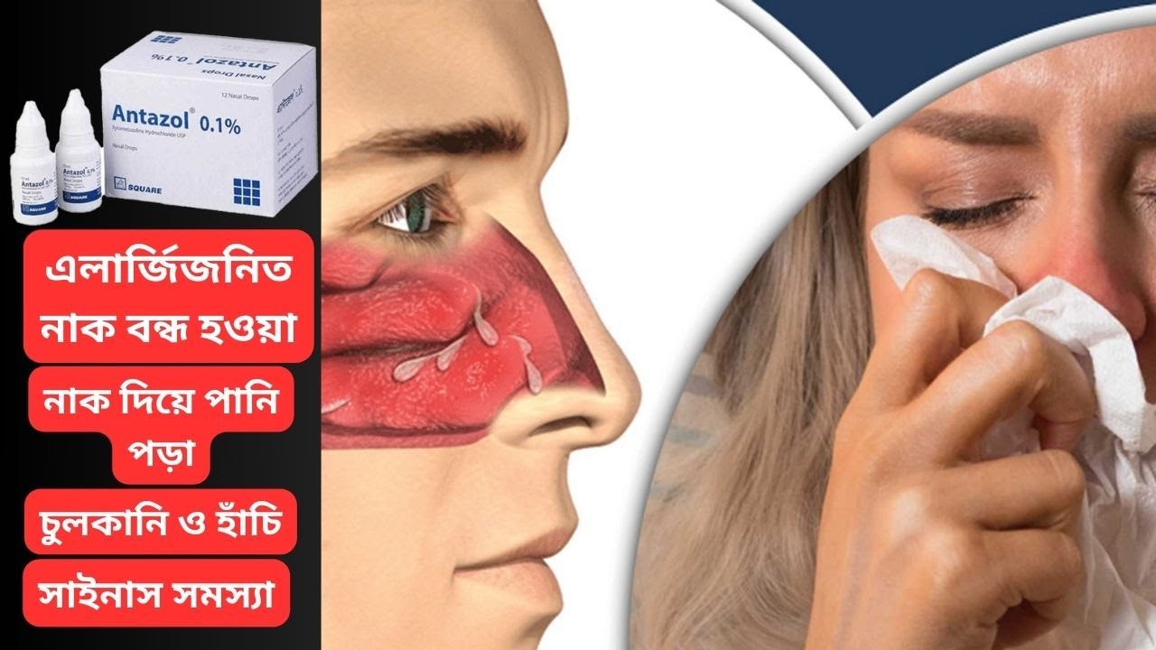 Antazol Nasal Drop এর কাজ কি | নাক বন্ধ হওয়া, নাক দিয়ে পানি পড়া ...