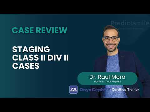 Staging Class II DIV II cases - YouTube