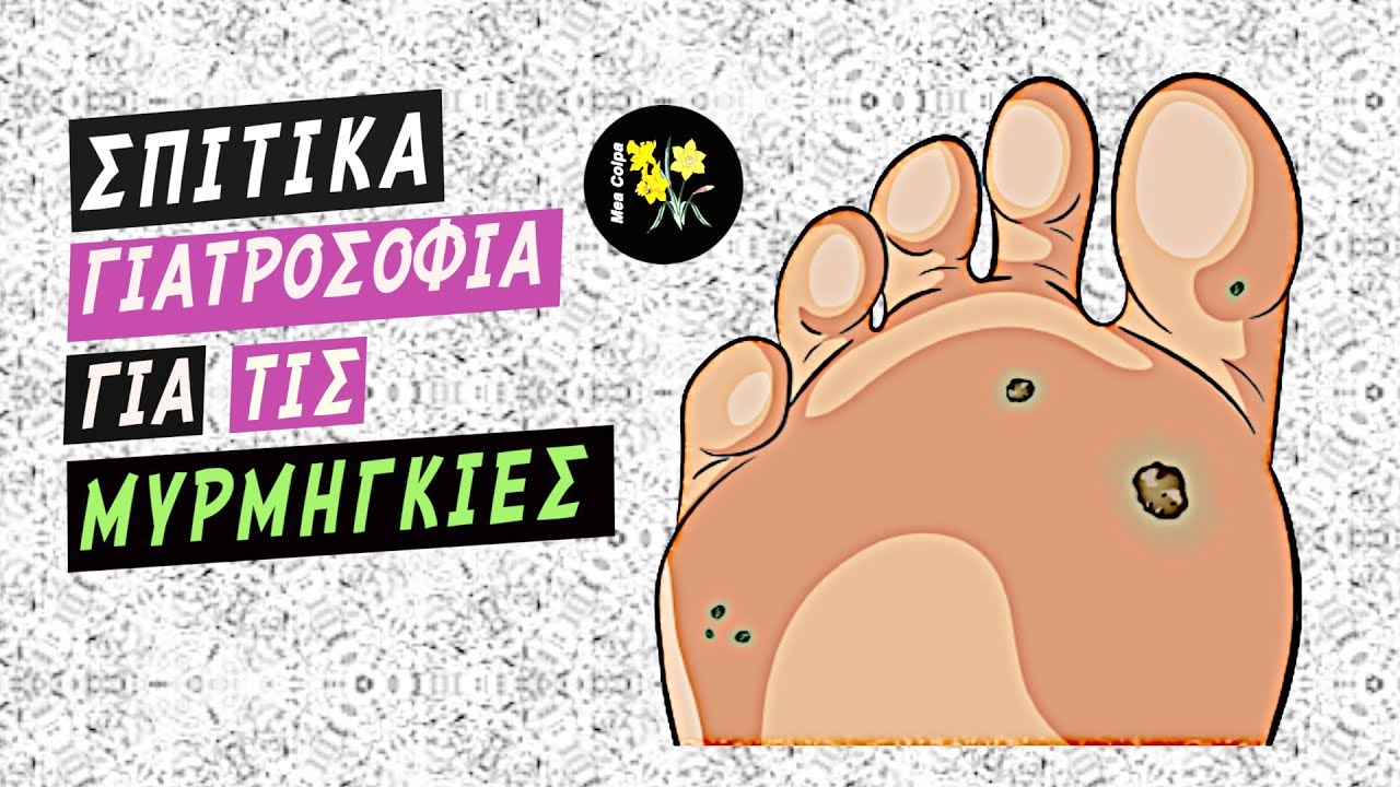 3 Σπιτικά Γιατροσόφια Για Τις Μυρμηγκιές - YouTube