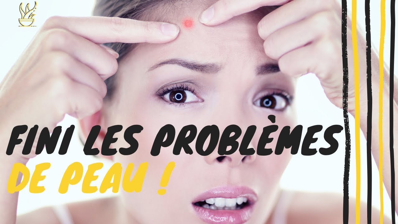 Les astuces de Jessica pour les "Problèmes de peau" - Forever Living ...