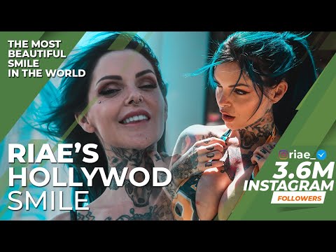 Riae's HOLLYWOOD SMILE in TURKEY