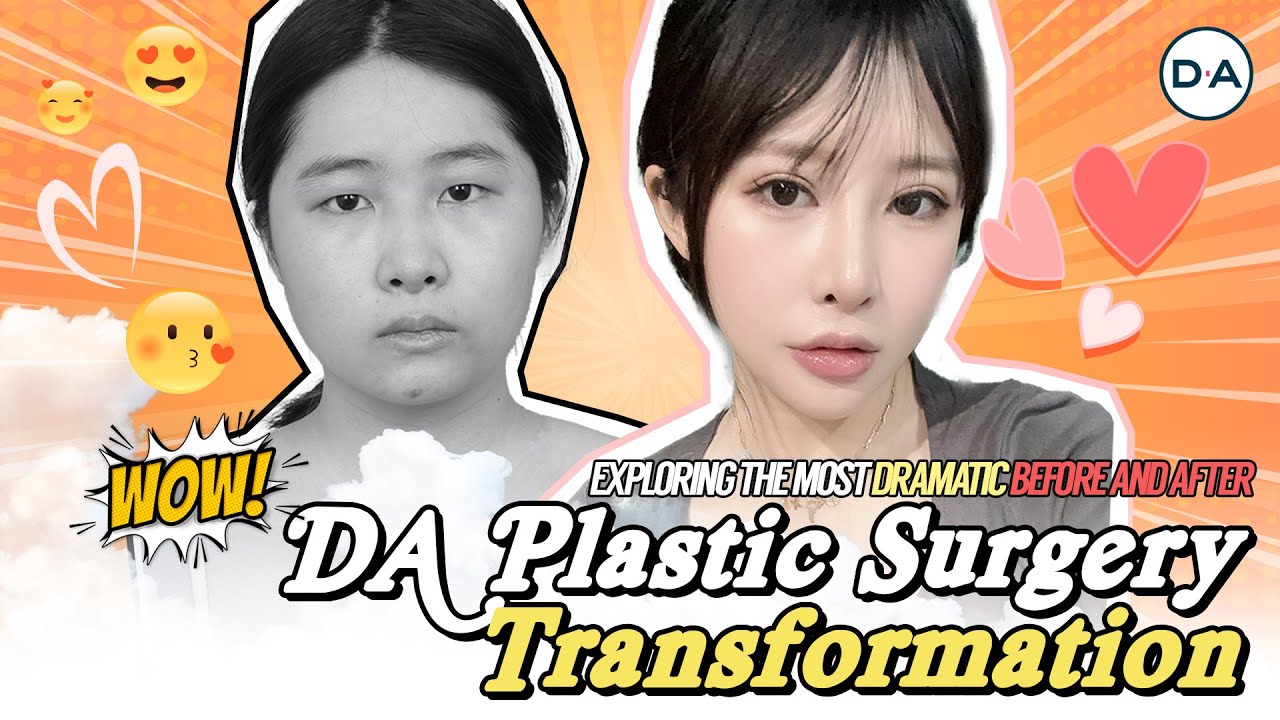 [Plastic Surgery Korea] Go Over Before After with Dr. Lee! DA Plastic Surgery 💖 - YouTube