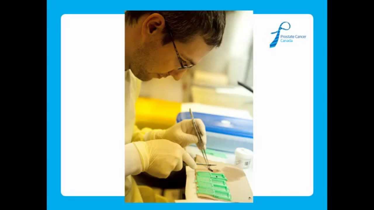 Expert Angle: Understanding Your Pathology Report - YouTube