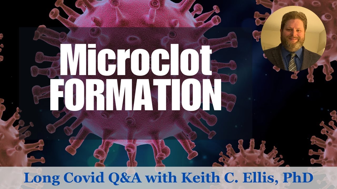 How Abnormal Microclots Form in Long Covid - YouTube