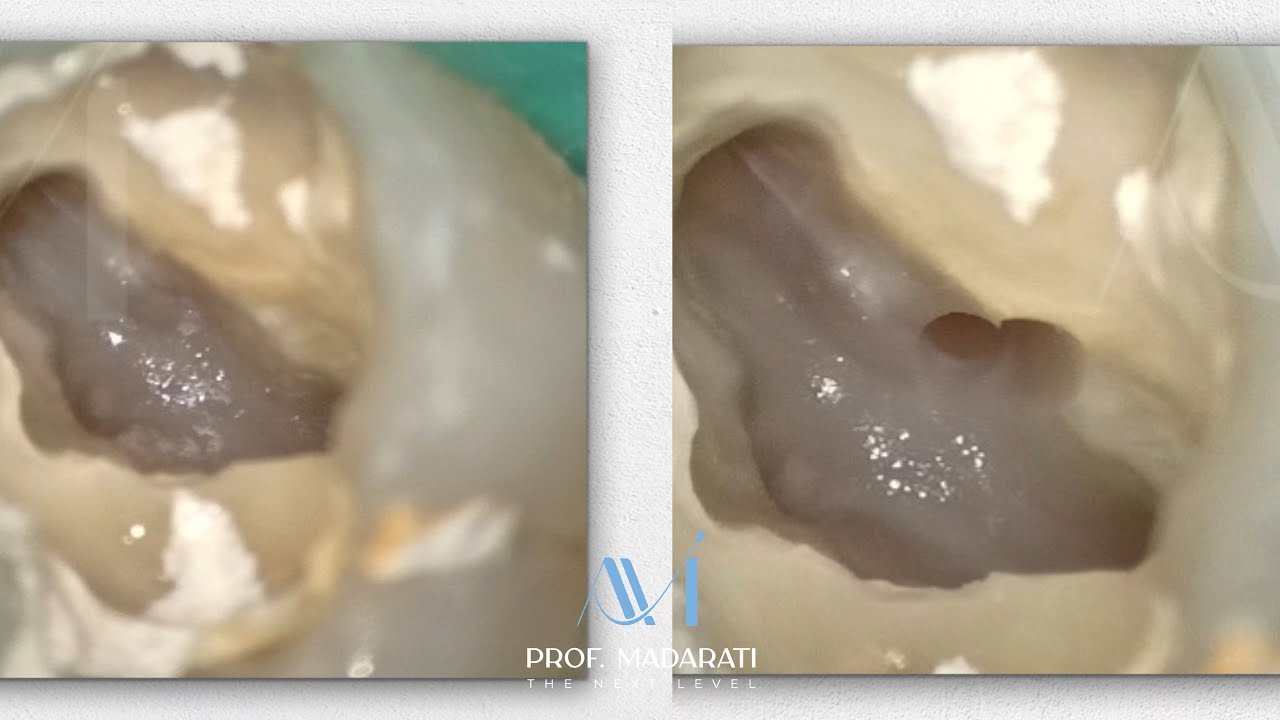 How to find MB2 ? - YouTube