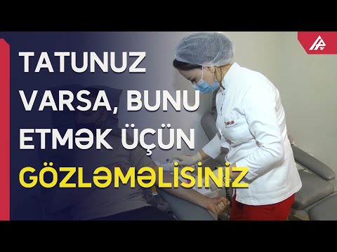 Kimlərə qan vermək qəti qadağandır? - ÖLÜMƏ SƏBƏB OLARSINIZ!