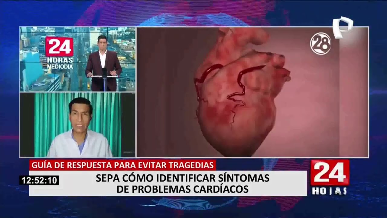 ¿Cómo identificar problemas cardiacos y qué debemos hacer? - YouTube
