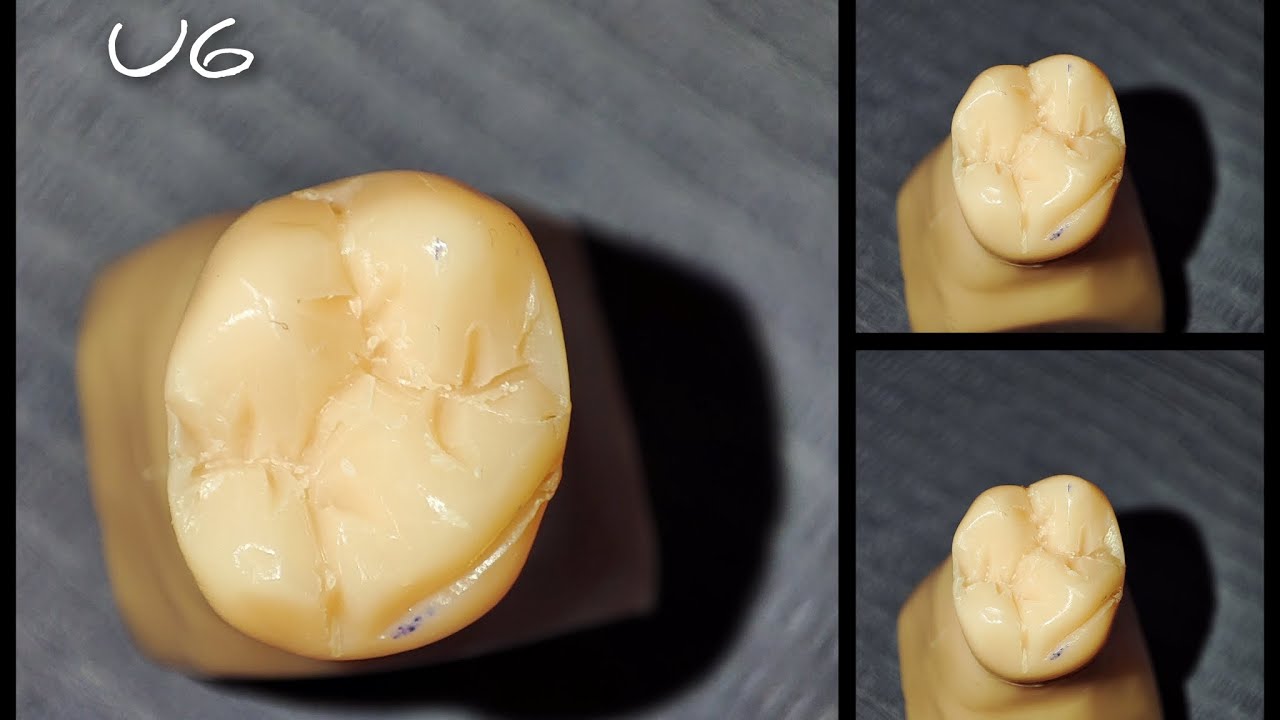 Maxillary First molar Carving with KH - صابون - YouTube