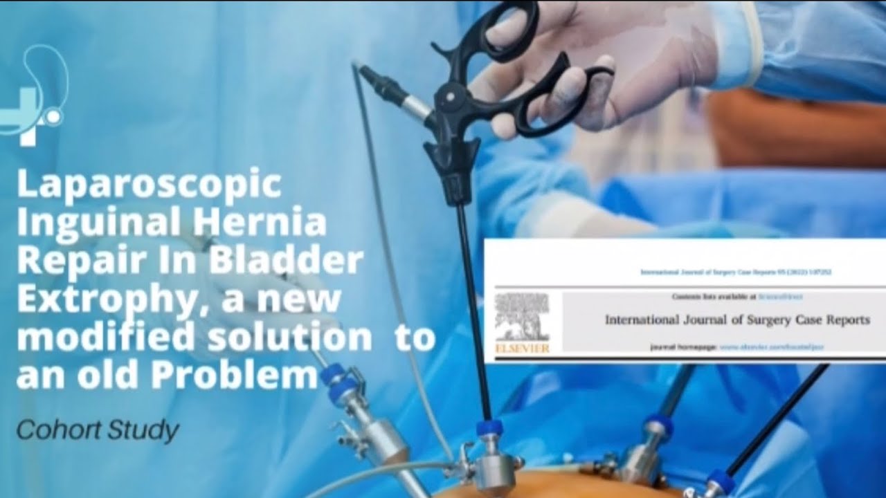 Laparoscopic repair of inguinal hernia in infants with bladder ...