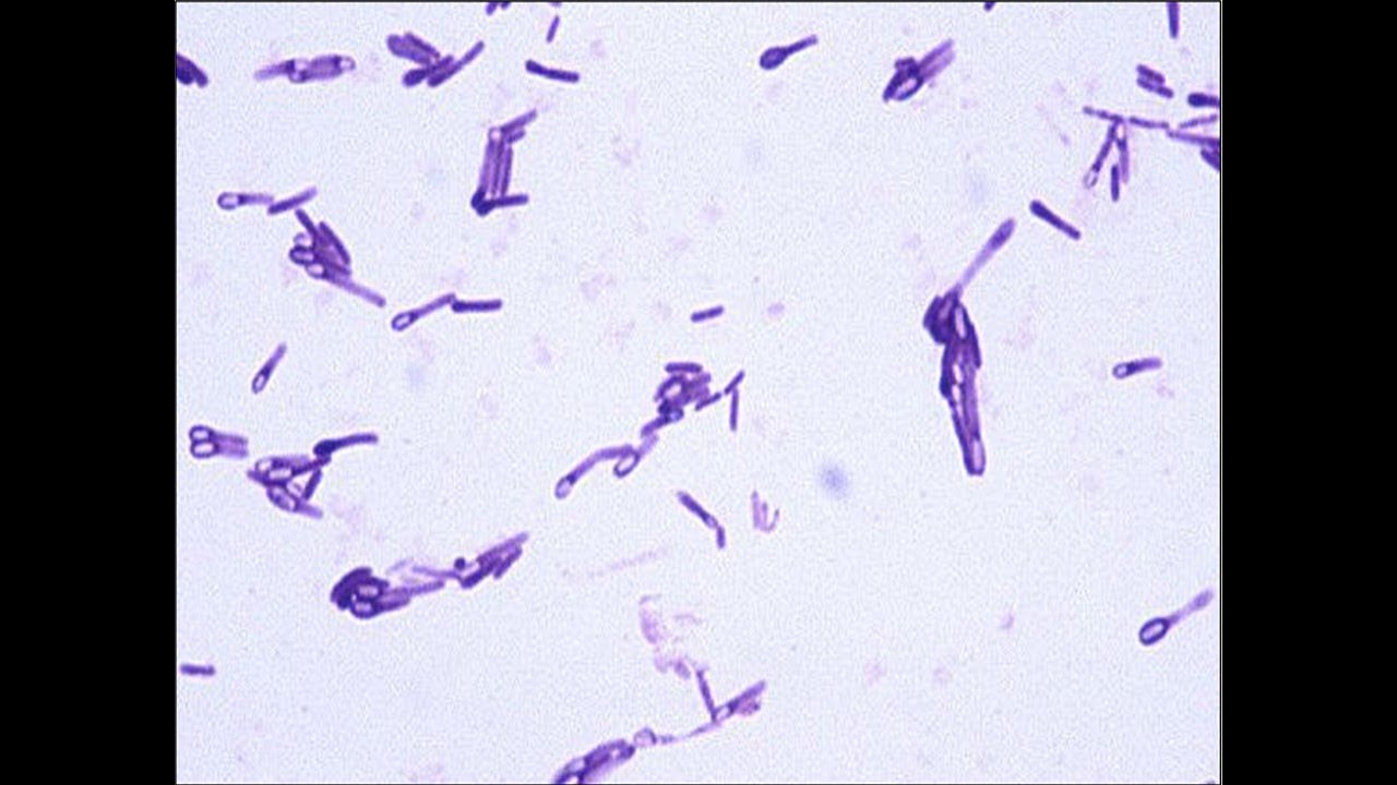 ONLINE Micro Lab 5: Bacterial Structure, Endospores, Capsules, and ...