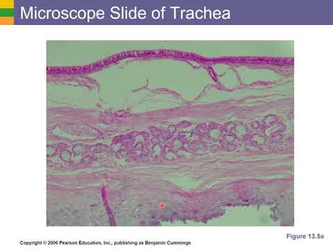 Microscope Slide of Trachea - YouTube
