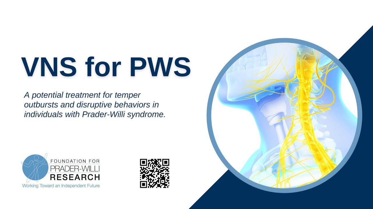 VNS for PWS Webinar - YouTube