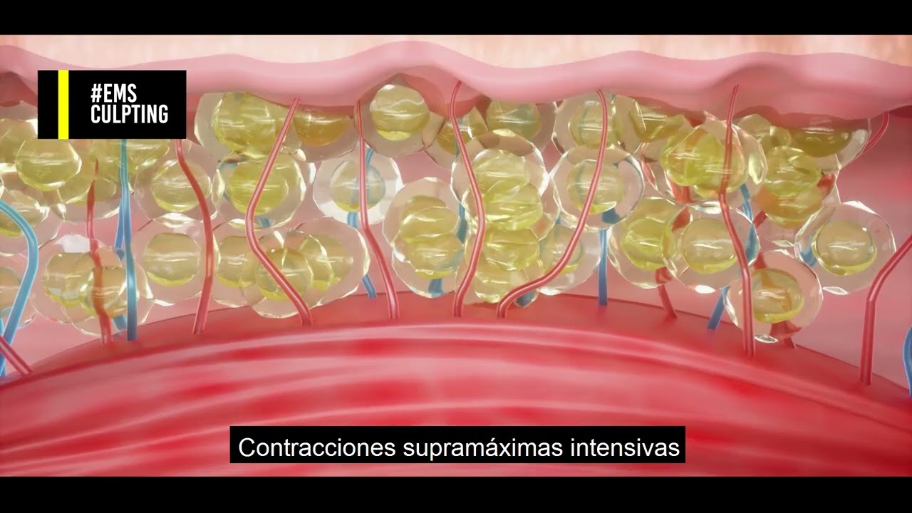 EM-CONTOURING | Dr. Jorge de León - YouTube