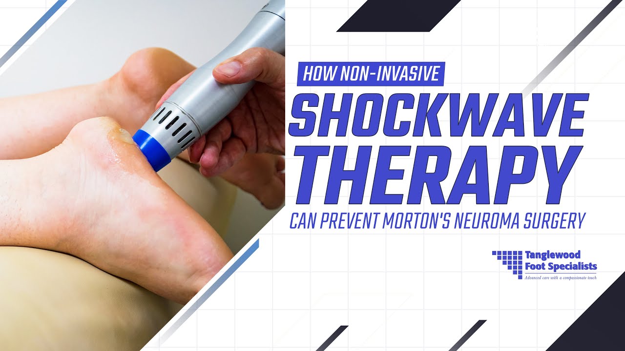 How Non Invasive Shockwave Therapy Can Prevent Morton's Neuroma Surgery ...
