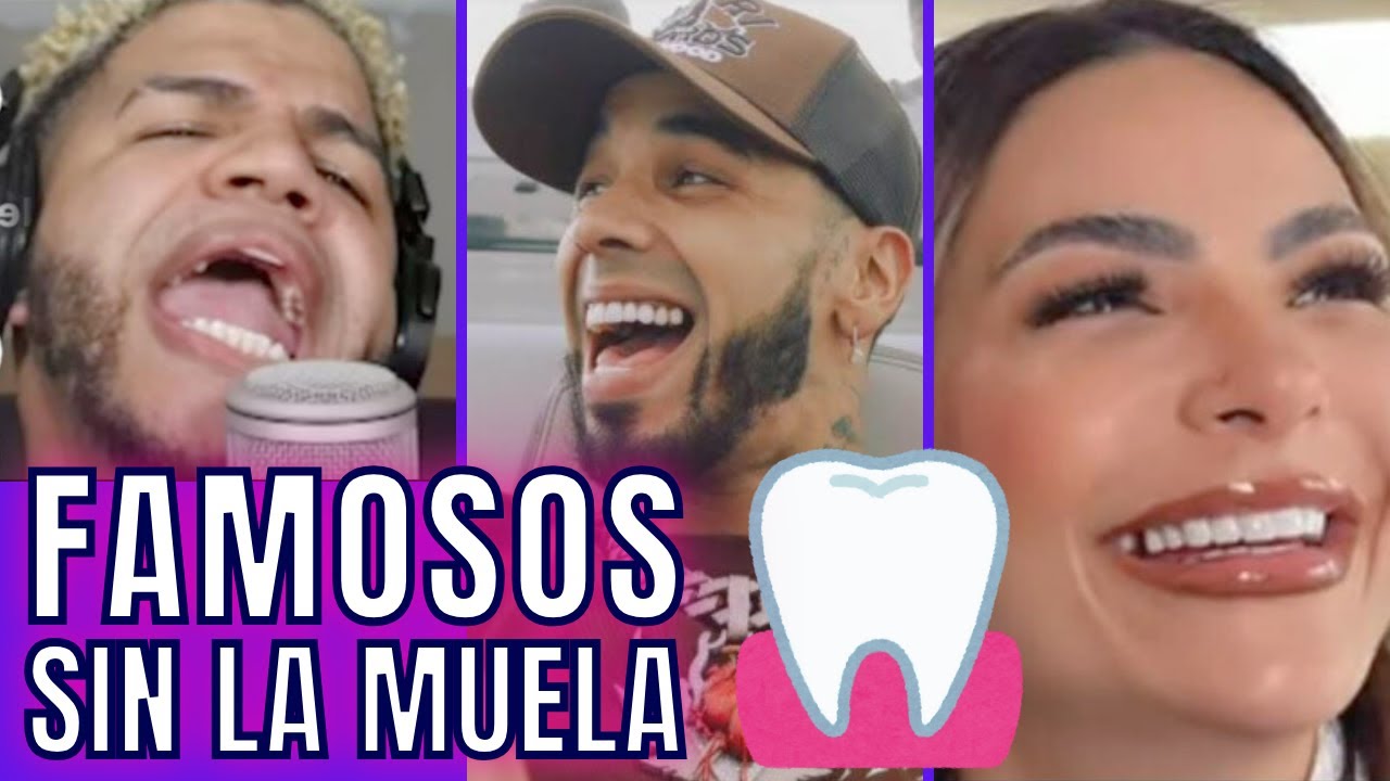 Personajes Famosos Sin Dientes 20 Famosos Que Mejoraron Con Carillas