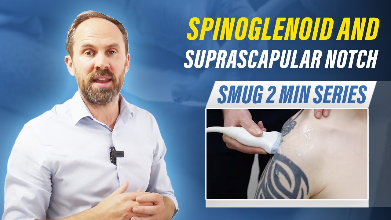 Spinoglenoid Notch