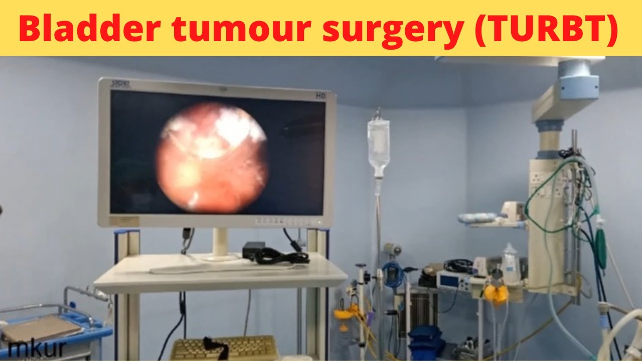 Bladder Tumour Surgery TURBT YouTube