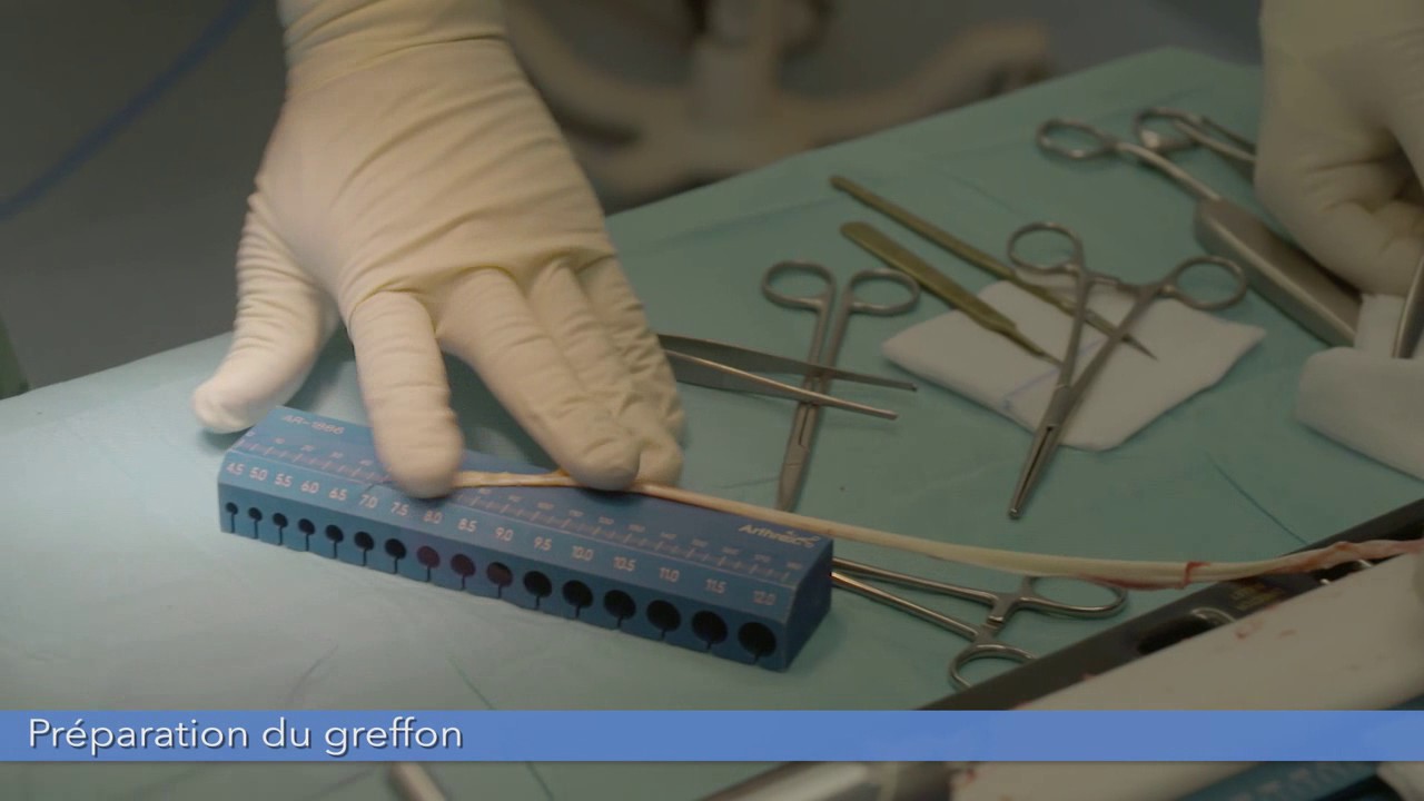 Préparation du Greffon - YouTube