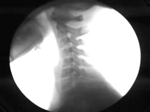 Digital Motion X-Rays - YouTube