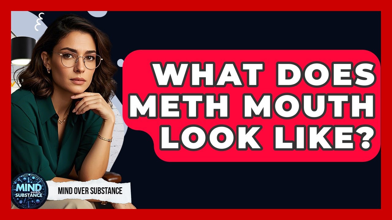 What Does Meth Mouth Look Like? - Mind Over Substance - YouTube