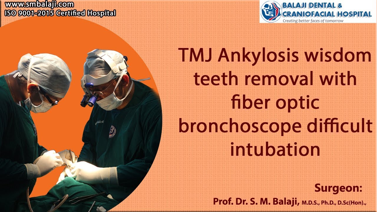 TMJ Ankylosis Wisdom teeth removal with fiber optic bronchoscope ...