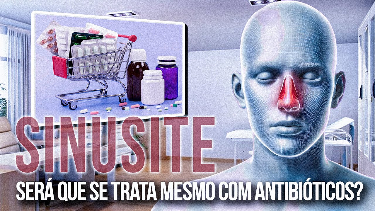 Toda #sinusite precisa ser tratada com antibióticos? Entenda qual ...