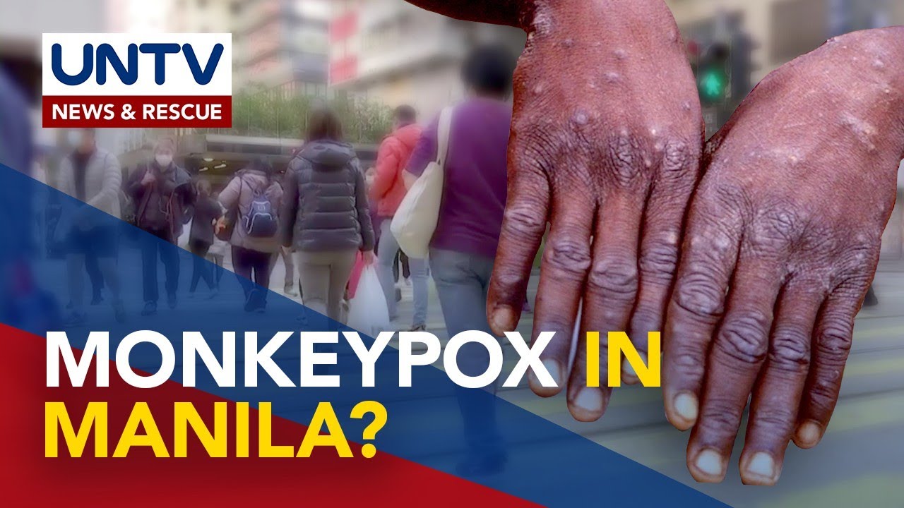 DOH, gathering info about monkeypox case reported in Manila-HK flight - YouTube