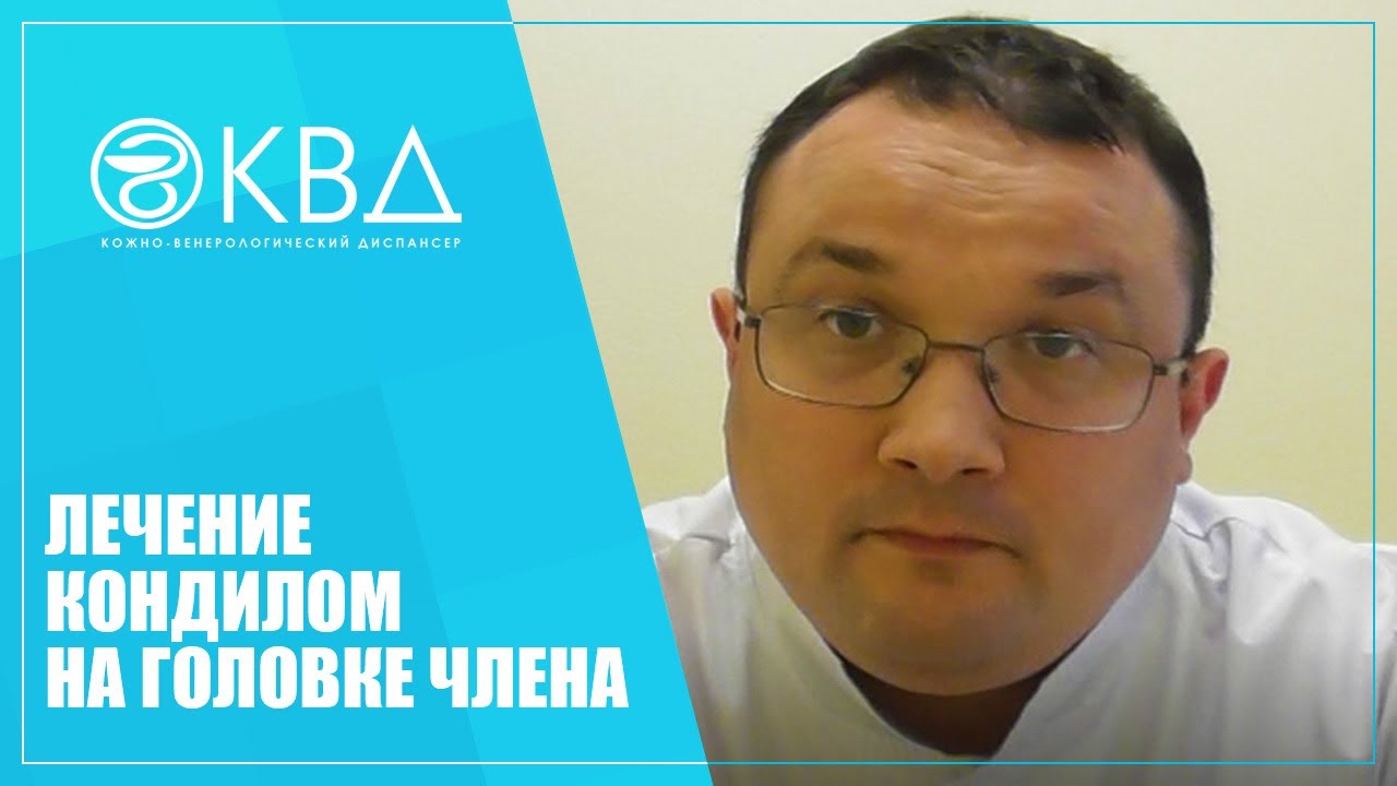 1140 Лечение кондилом на головке члена Youtube