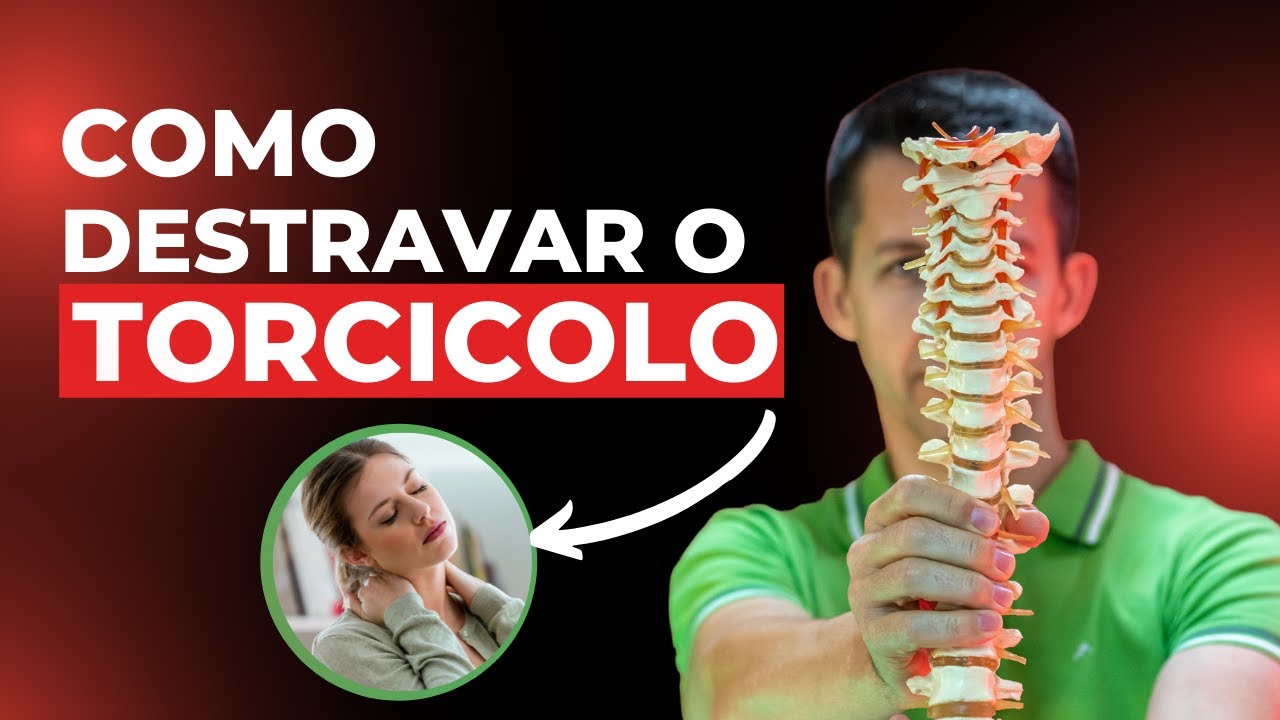 O QUE FAZER PARA MELHORAR O TORCICOLO - YouTube