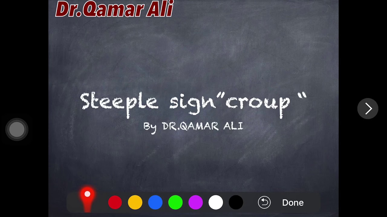 Steeple sign “ croup “ x-ray , reading and diagnosis - YouTube