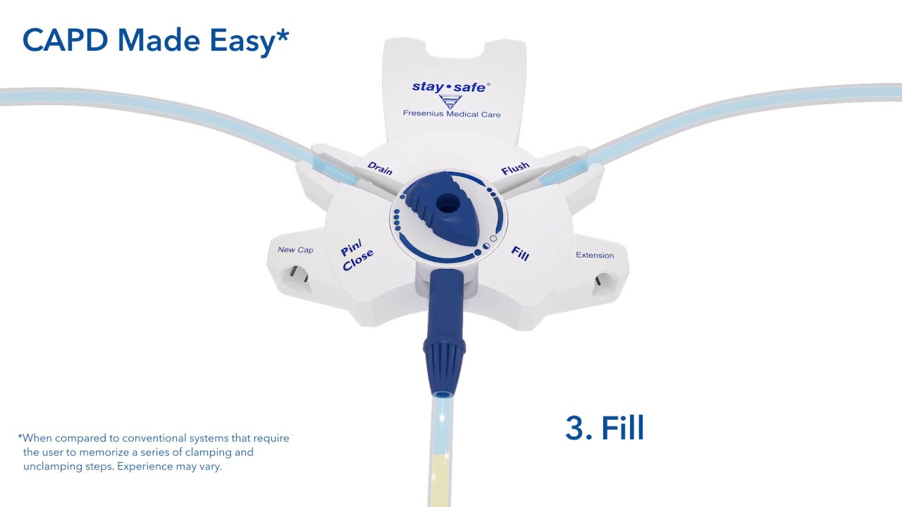Dialyze with Confidence | stay∙safe® Connectology - YouTube