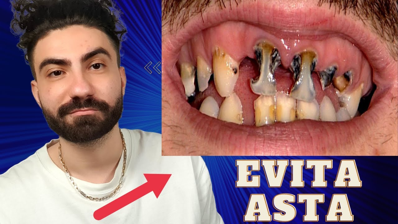 8 lucruri care îți DISTRUG DINȚII | Cum să le OPREȘTI - YouTube