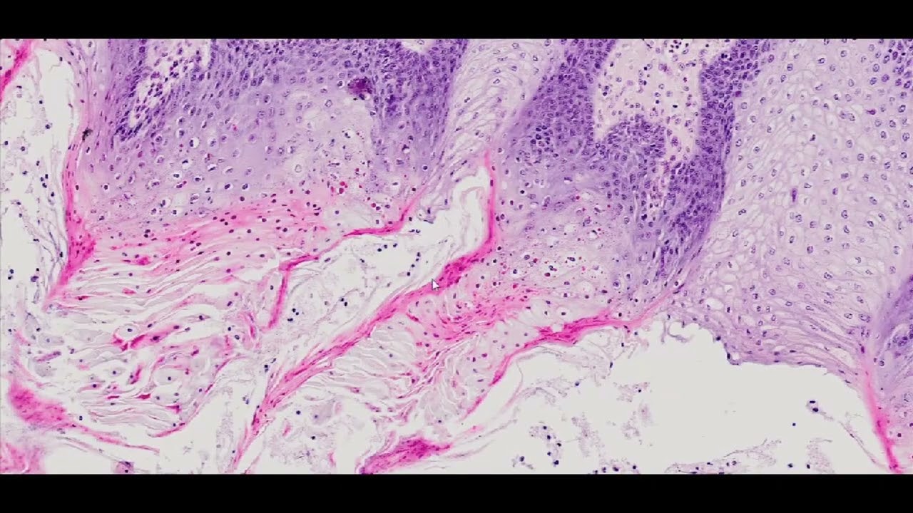 Fungiform Papillae Histology