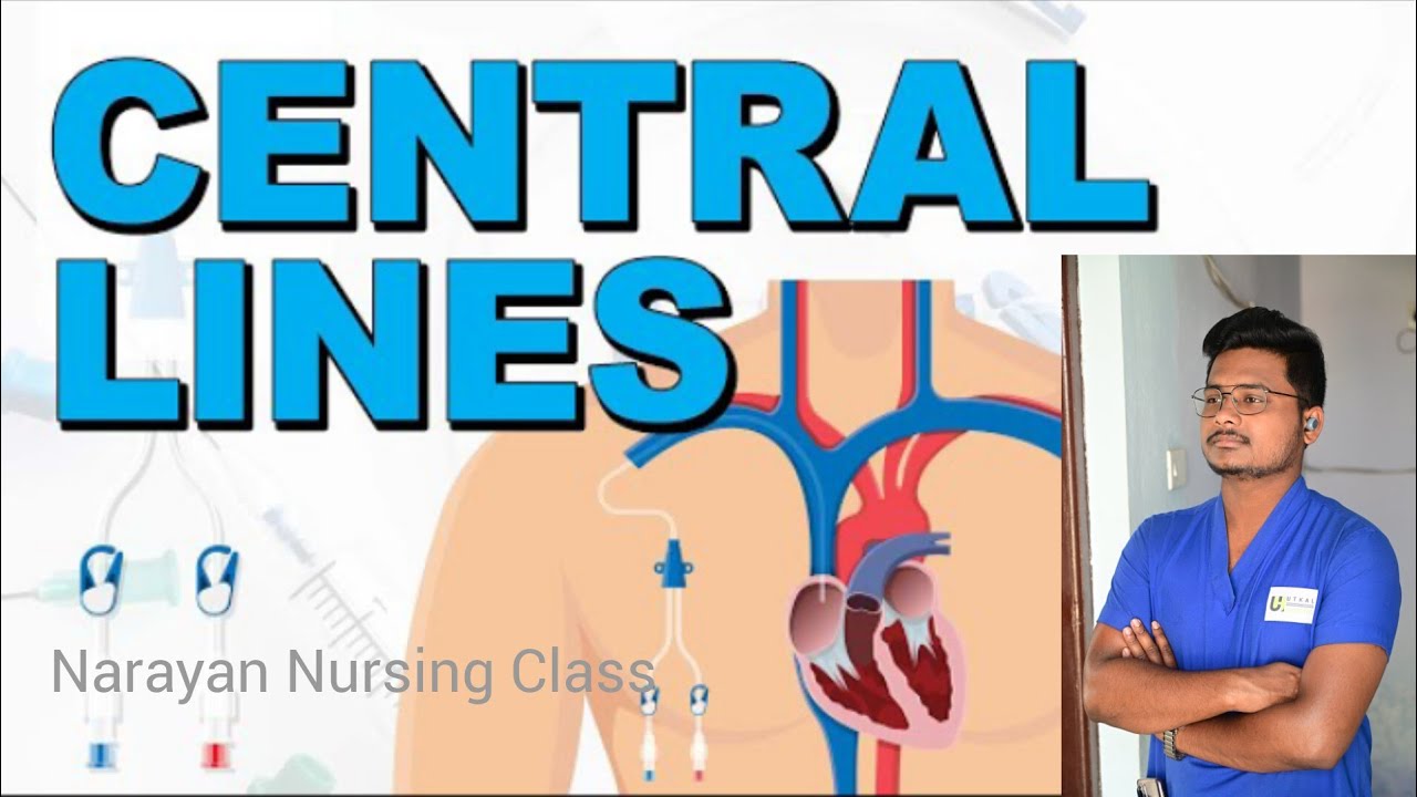 centraline procedure || central venous catheter insertion animation ...