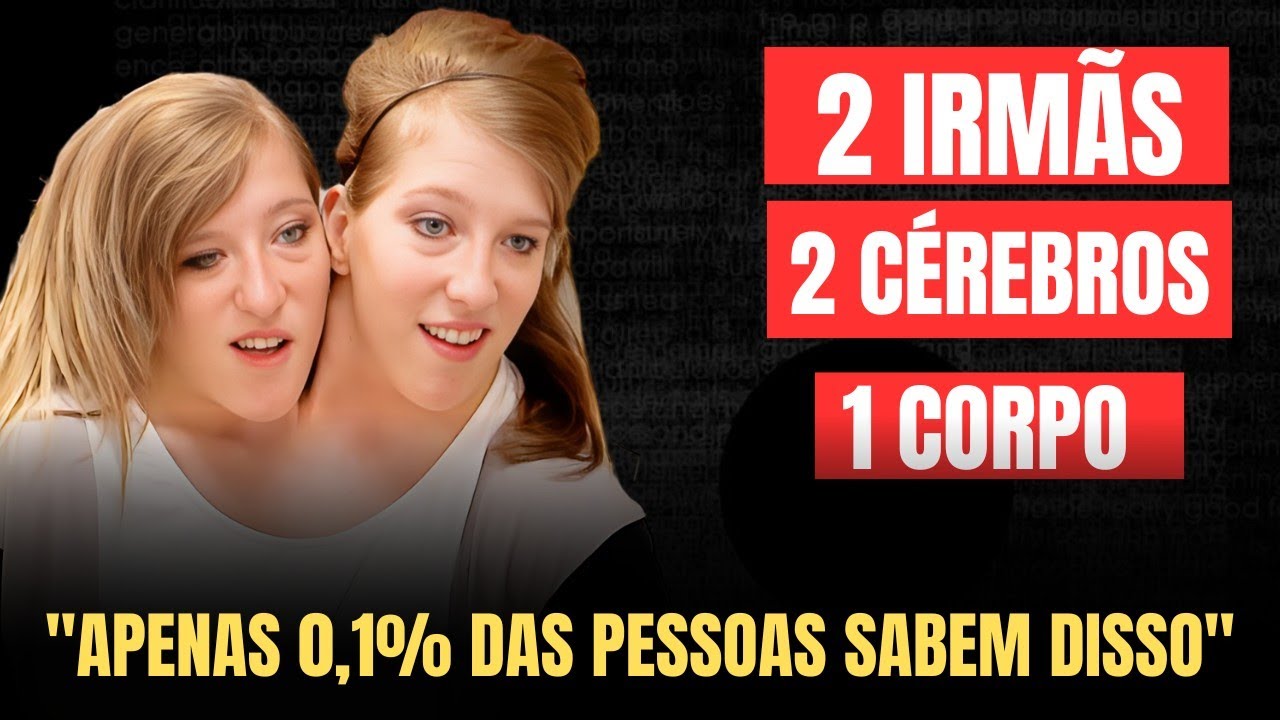 A história comovente das gêmeas siamesas Abby e Brittany Hensel 😭 - YouTube