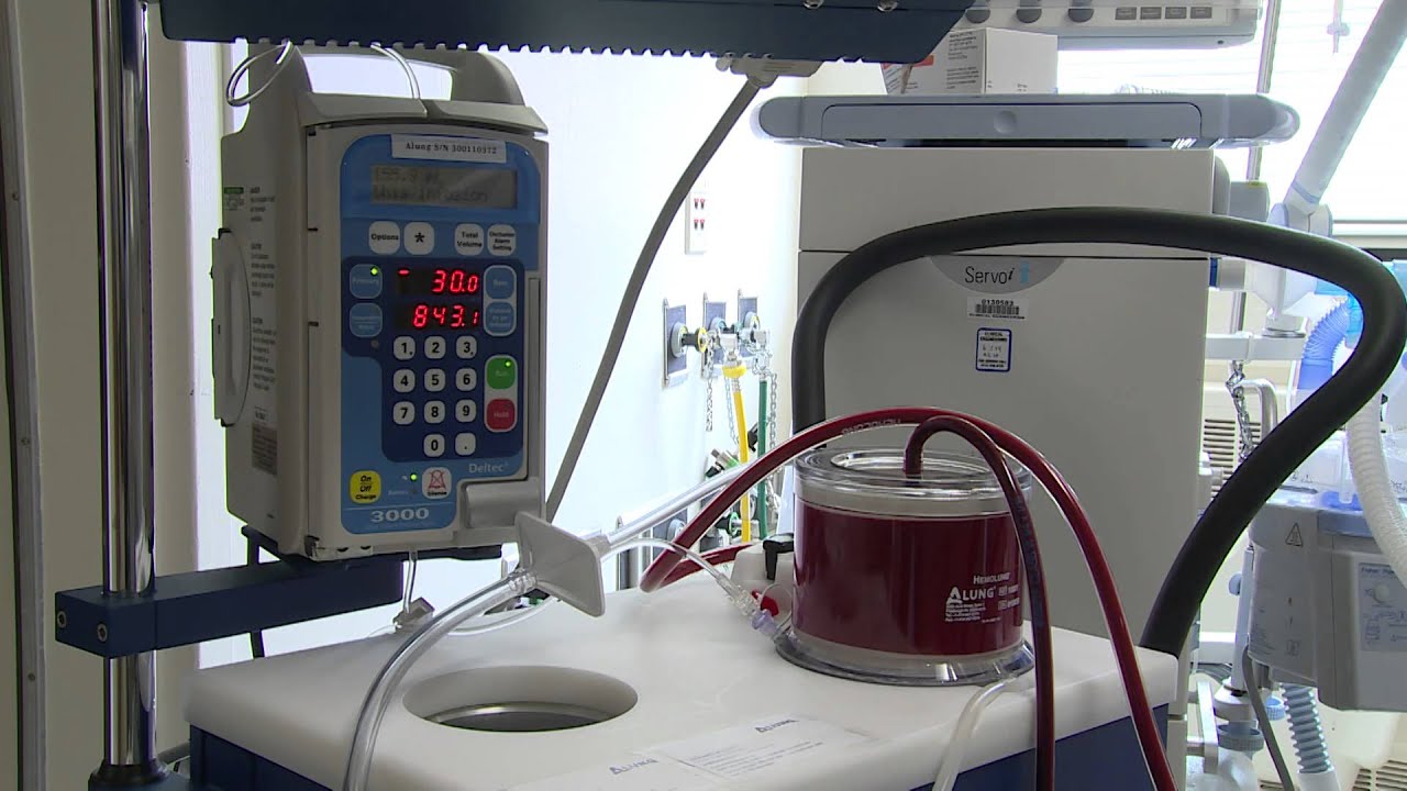 UPMC Double Lung Transplant Patient First in U.S. to Use Hemolung ...