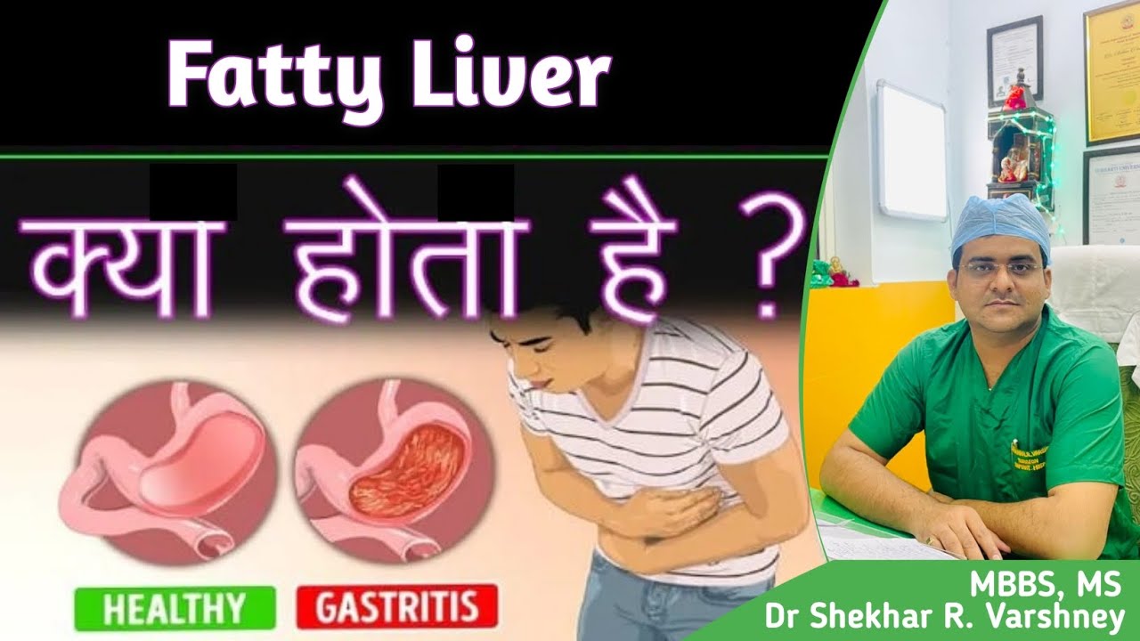 What is Fatty Liver 🤯. Dr shekhar R varshney (MBBS MS). #doctor # ...