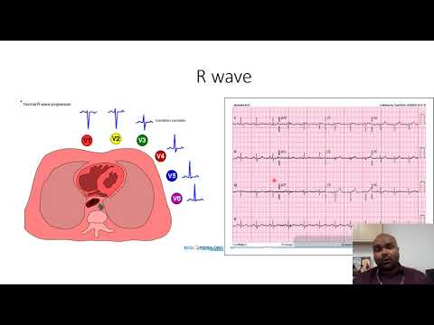ECG Interpretation 7 (QRS Morphology) - YouTube