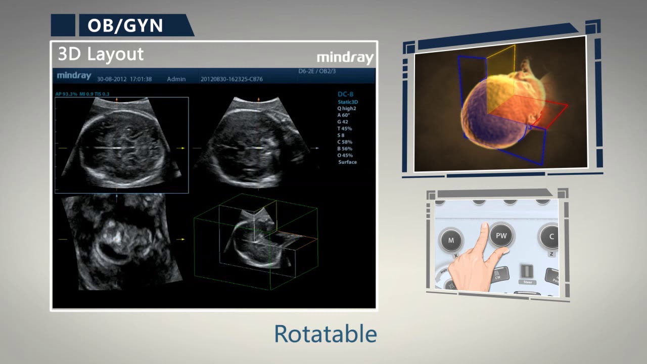 Ultrasonography 3D / 4D SCANNING Technic - YouTube
