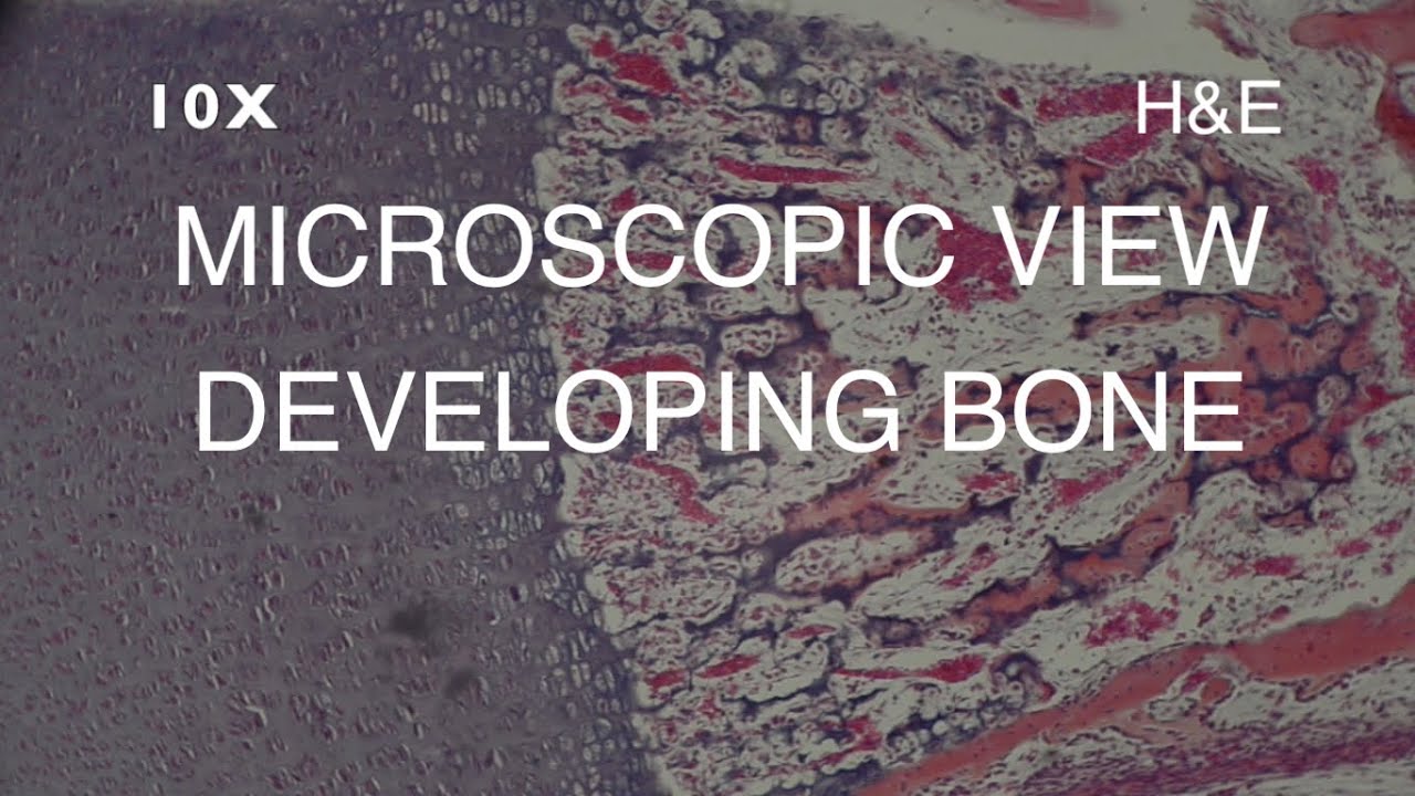 MICROSCOPIC VIEW - DEVELOPING BONE - YouTube