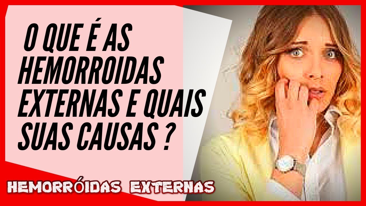 Hemorroidas Externas💜💜 Saiba A Verdade Sobre As Hemorroidas Externas E