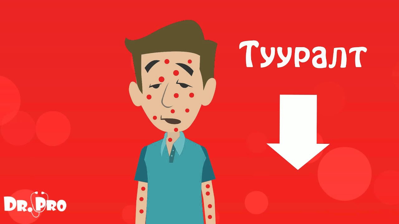Улаанбурхан гэж юу вэ Хэрхэн энэхүү өвчнөөс сэргийлэх вэ Youtube