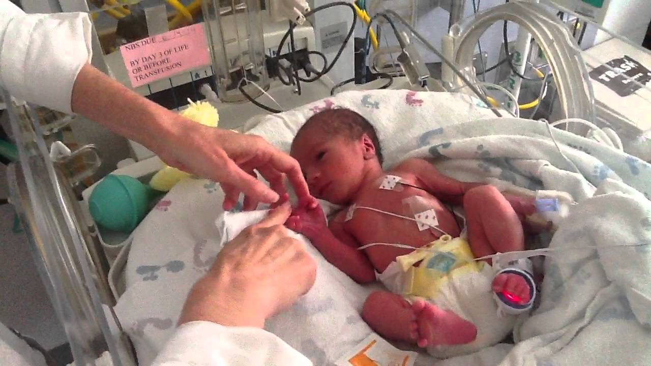 Born At 34 Weeks And Healthy As Can Be YouTube