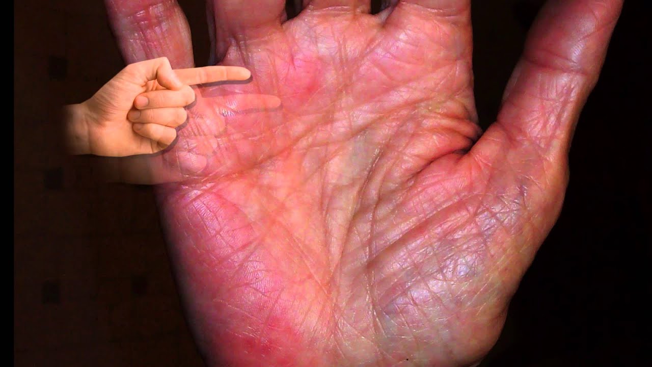 MONEY LINE: PALM READING PALMISTRY #46 - YouTube