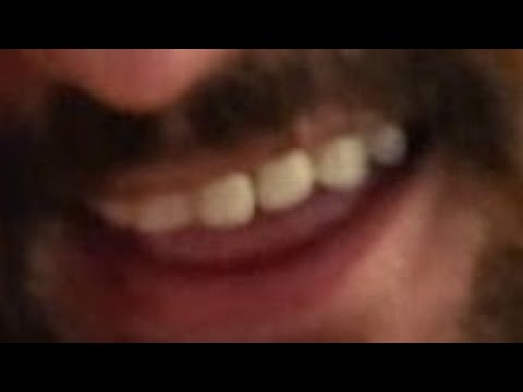 BIPOLAR BOZUKLUK VE LITYUM TEDAVISI