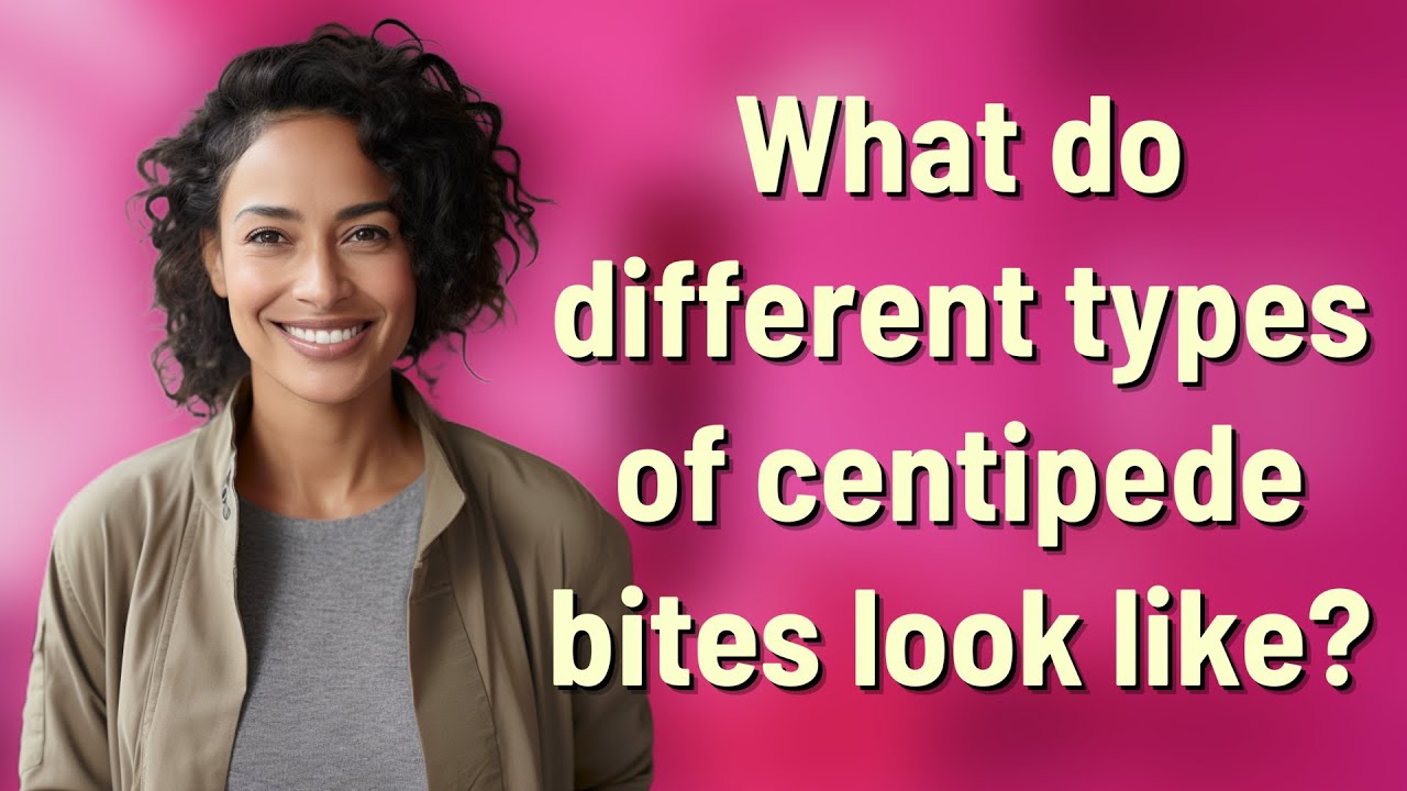 What do different types of centipede bites look like? - YouTube