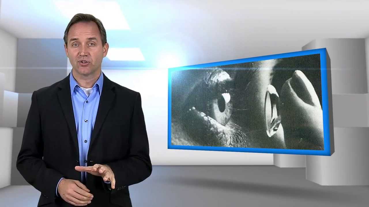 Master Eye Associates - Contact Lens Care Specialists - YouTube