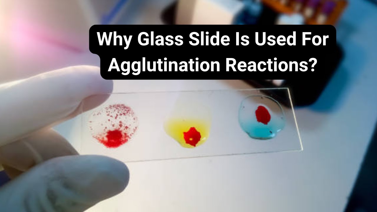 Why Glass Slide Is Used For Agglutination Reactions - Hindi #shorts # ...